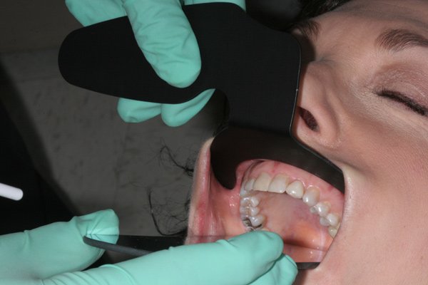 DentalStores.in: Buy Dental Products Online at Best Price