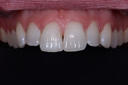 DentalStores.in: Buy Dental Products Online at Best Price