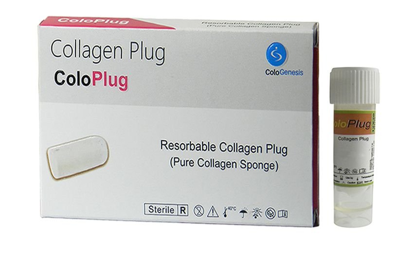 Cologenesis Colo Plug Sterile Collagen Sponge 1pk