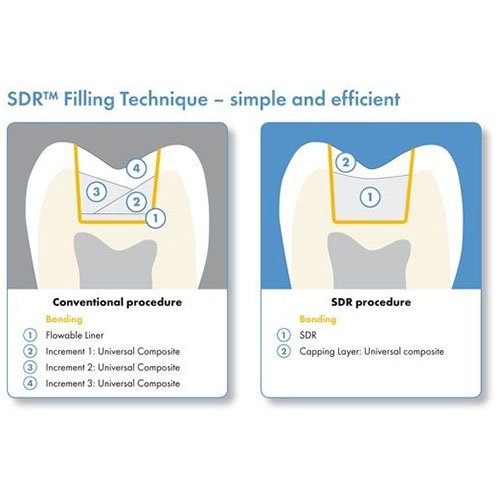 DentalStores.in: Buy Dental Products Online at Best Price